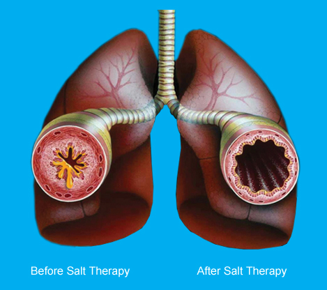 The Salt Therapy Clinic & Sanctuary – Breathe. Live. Relax. Sleep Better